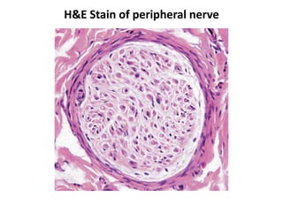 Peripheral nerve biopsy | PPTX