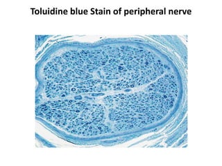 Peripheral nerve biopsy | PPTX