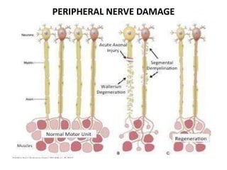 Peripheral nerve biopsy | PPTX