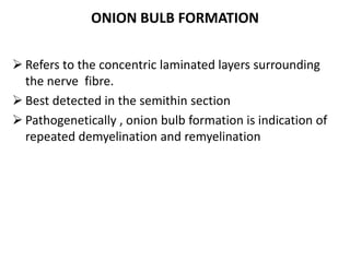 Peripheral nerve biopsy | PPTX