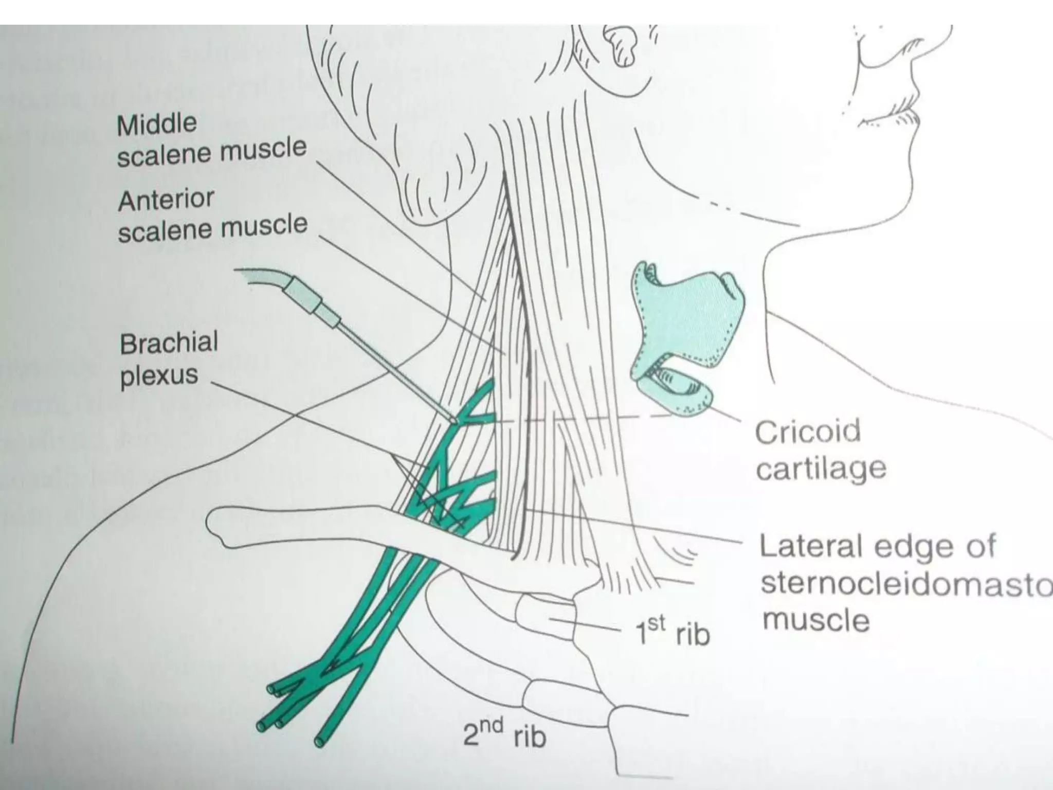 Peripheral nerve blocks | PPTX