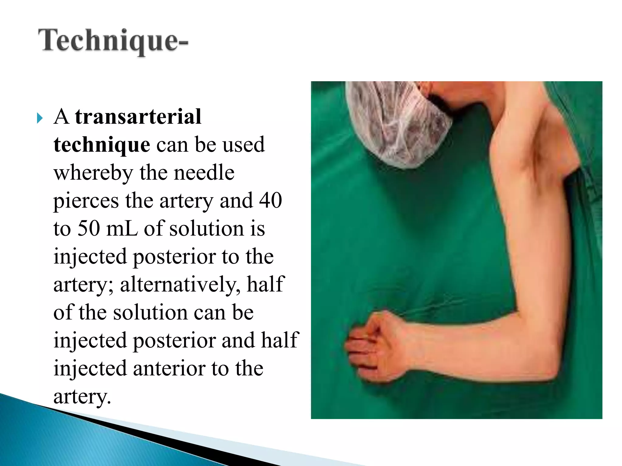 Peripheral nerve blocks | PPTX