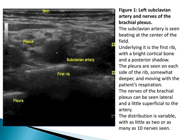 Peripheral nerve blocks | PPTX | First Aid | Injuries