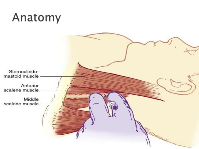 Peripheral nerve blocks | PPTX | First Aid | Injuries