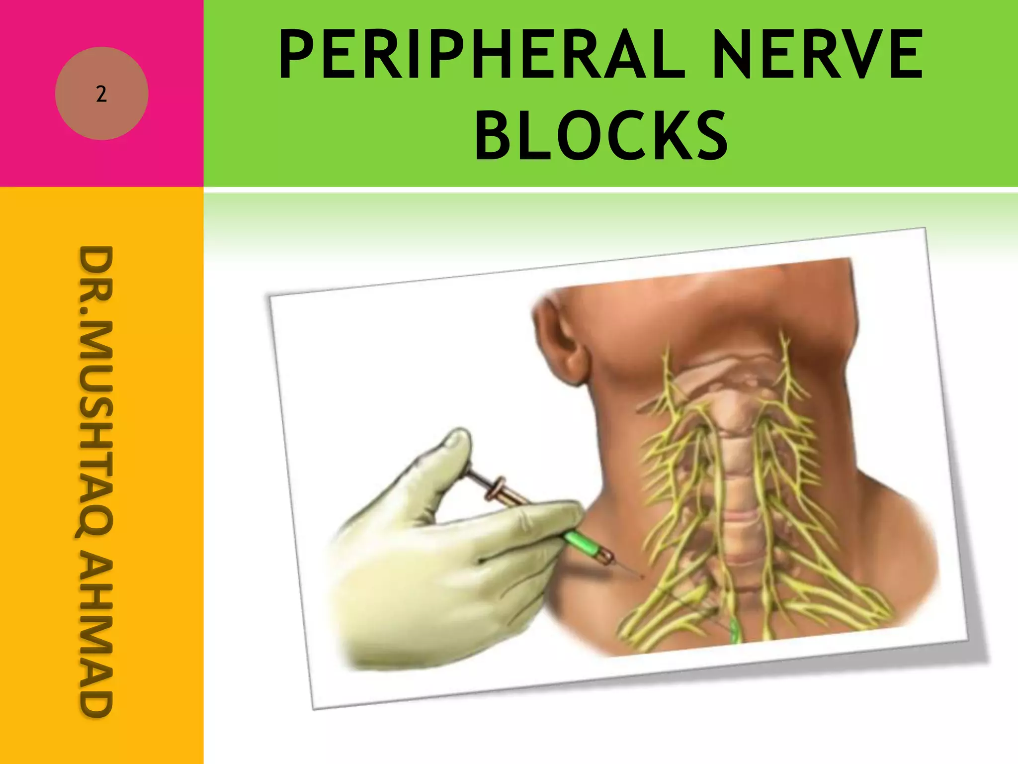 Peripheral nerve blocks 1 by dr.mushtaq | PPTX