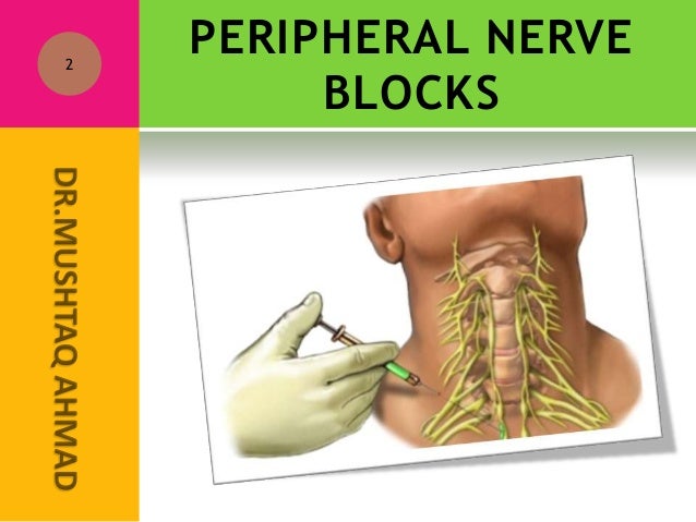 Peripheral nerve blocks 1 by dr.mushtaq