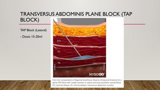 Peripheral Nerve Block Supraclavicular dan TAP.pptx