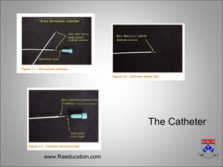 Peripheral Nerve Catheters | PPT
