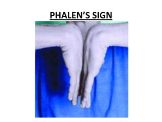 Peripheral nerve disorders | PPTX