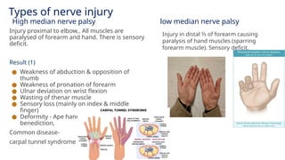PERIPHERAL NERVE INJURIES (presented by pranjal).pptx