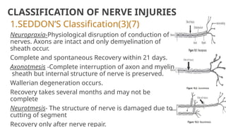 PERIPHERAL NERVE INJURIES (presented by pranjal).pptx