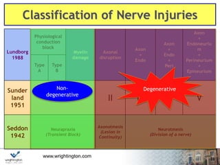 Peripheral nerve injuries | PPT