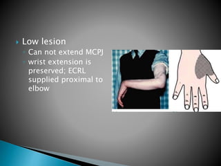 Peripheral nerve injuries | PPTX