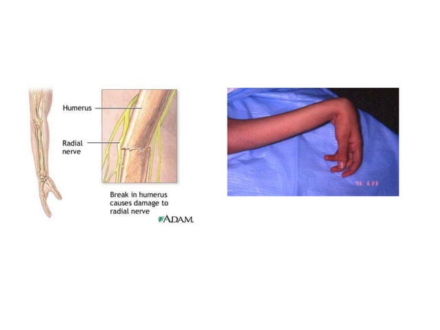 peripheral nerve injuries.physiology.pptx