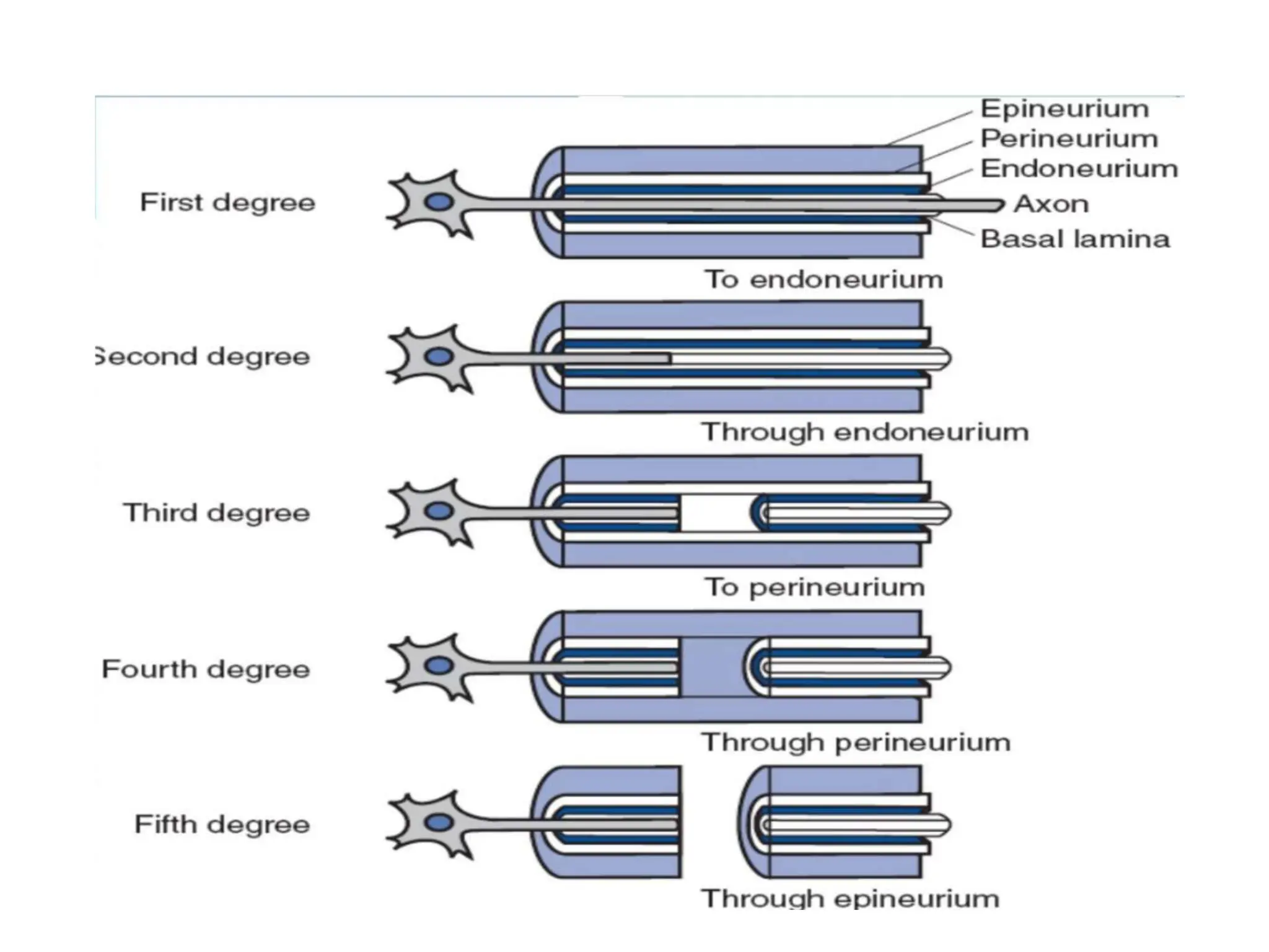 peripheral nerve injuries CLASSSIFICATION.pptx