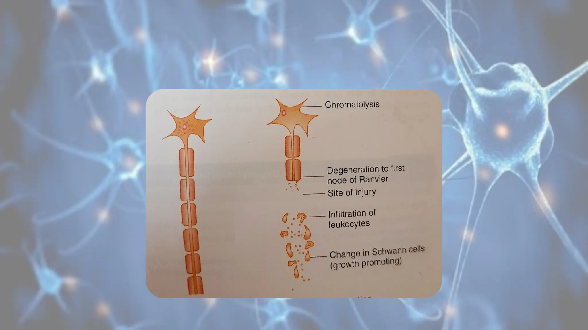 peripheral nerve injuries- classification and manifestations | PPTX