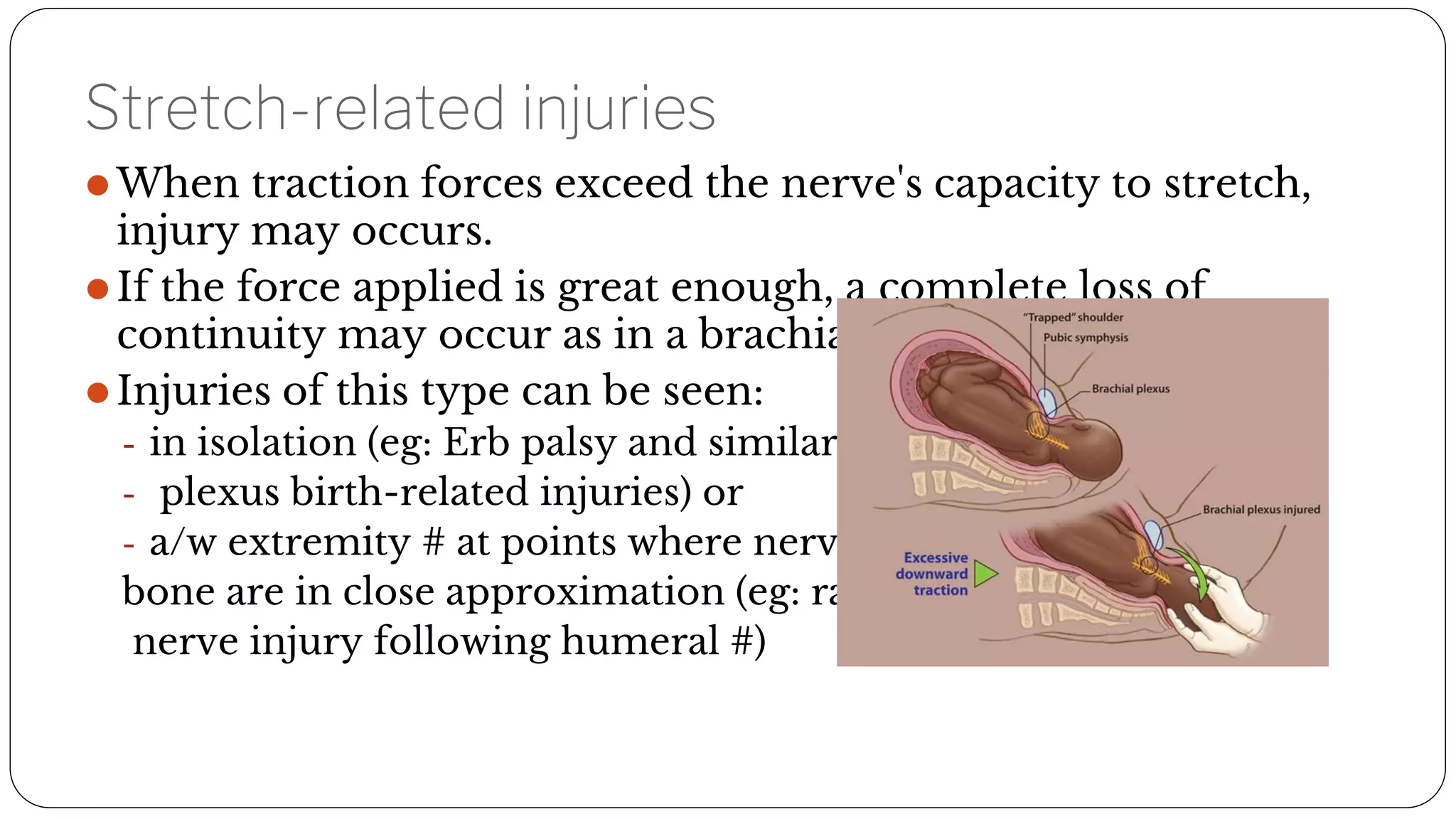 Peripheral nerve injuries.pptx