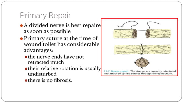 Peripheral nerve injuries.pptx