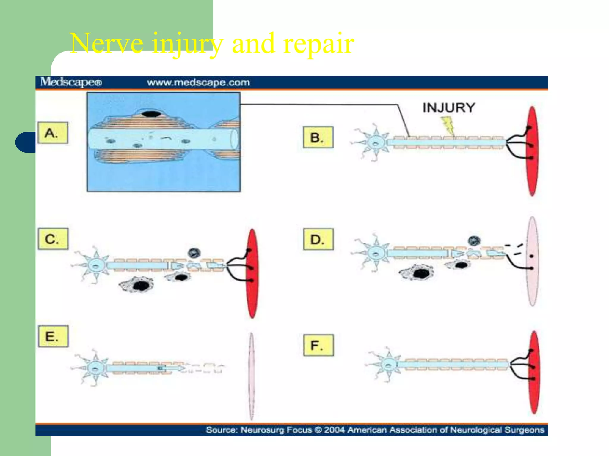 Peripheral_Nerve_Injuries (1).ppt