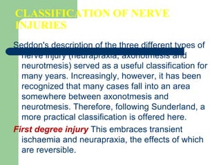 Peripheral_Nerve_Injuries (1).ppt