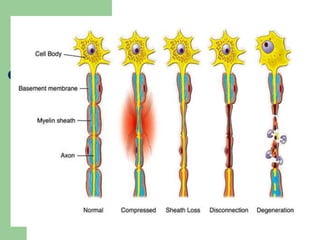 Peripheral_Nerve_Injuries (1).ppt