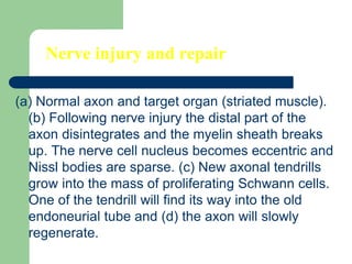 Peripheral Nerve Injuries 1 Ppt