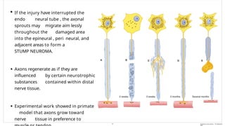 Peripheral nerve injuries (1).pptx peripheral nerve injury | PPTX
