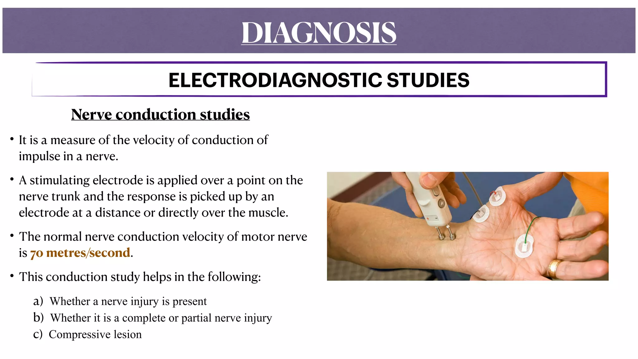 Peripheral nerve injuries by Dr.Harishma R.pdf
