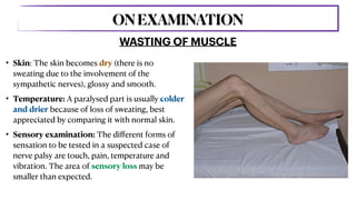 Peripheral nerve injuries by Dr.Harishma R.pdf