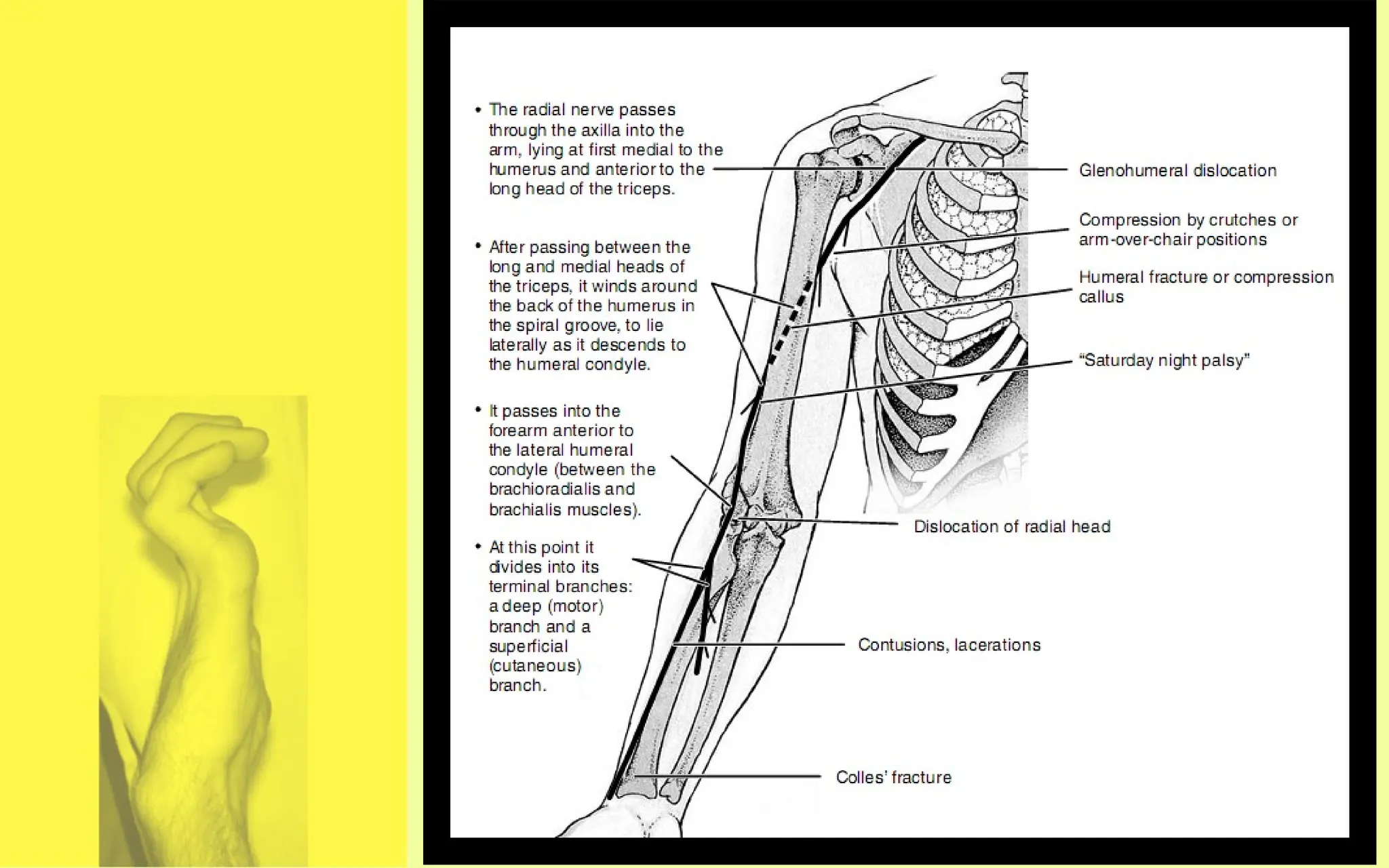 Peripheral Nerve Injuries of the Upper Limb.pptx