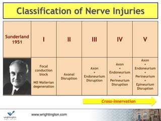 Peripheral Nerve Injuries | PPTX