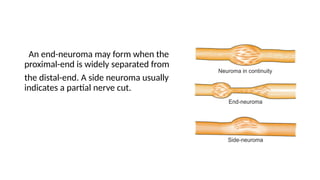 peripheral nerve injury and examinations | PPT