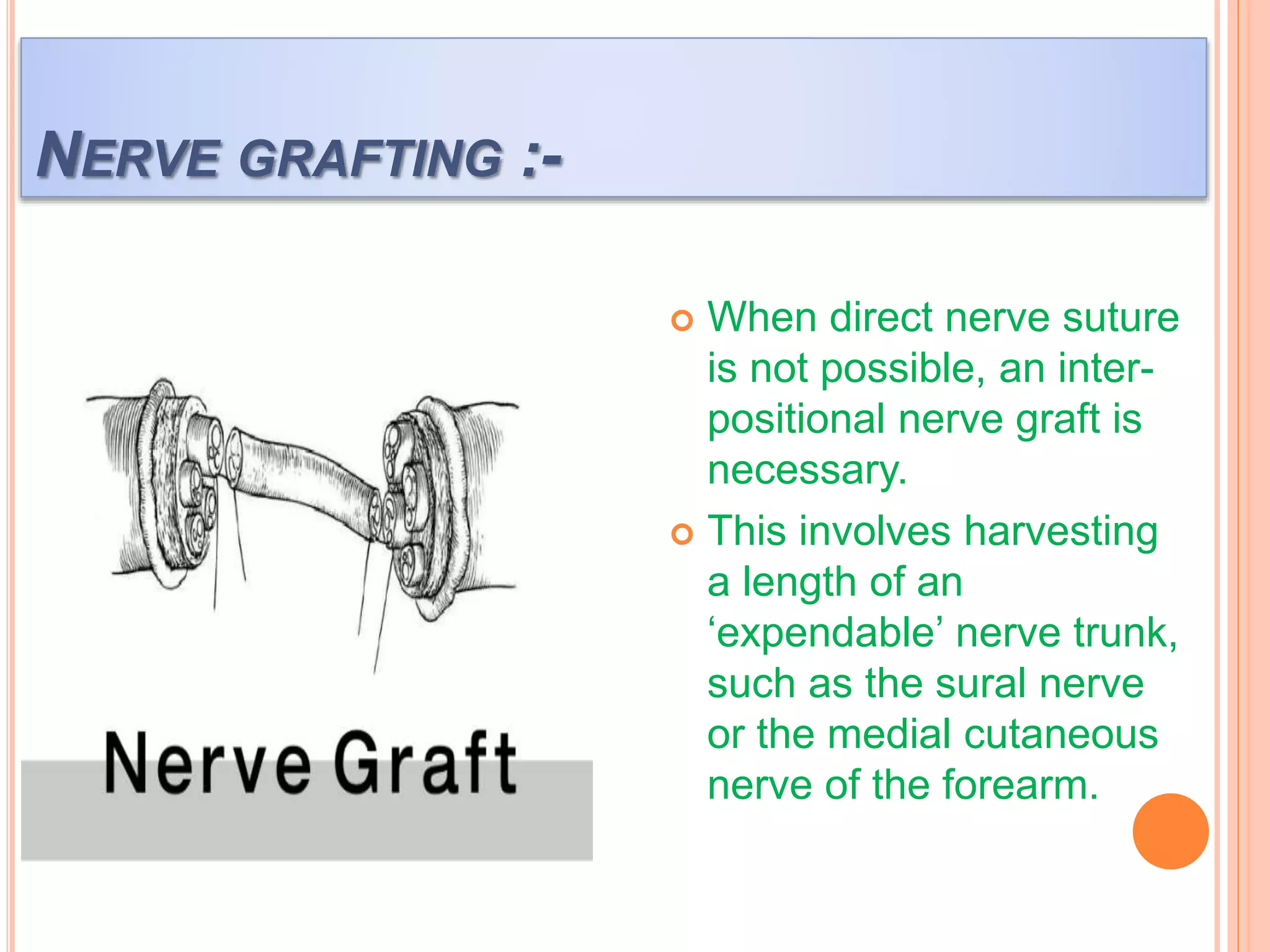 Peripheral nerve injury | PPTX