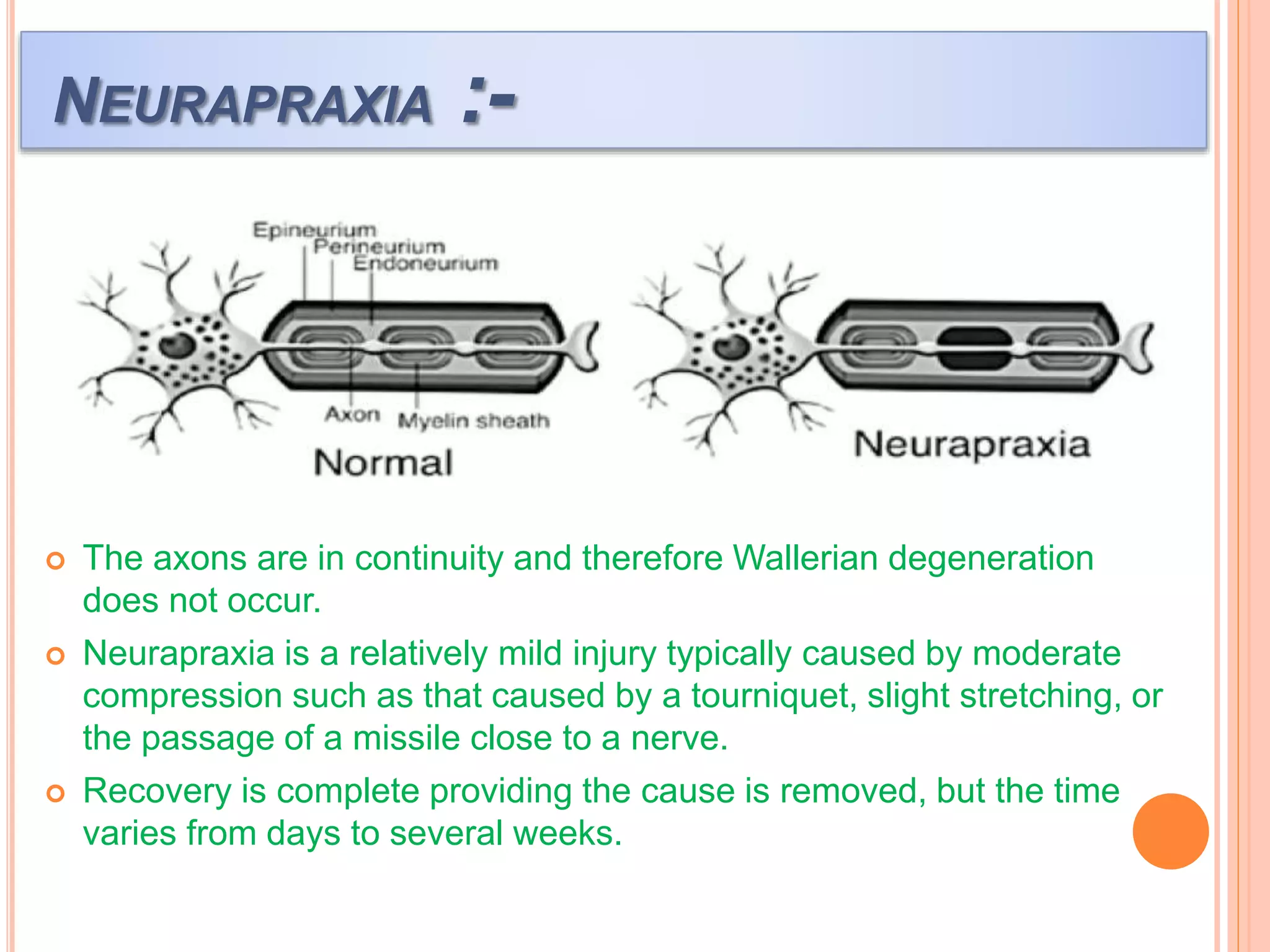 Peripheral nerve injury | PPTX