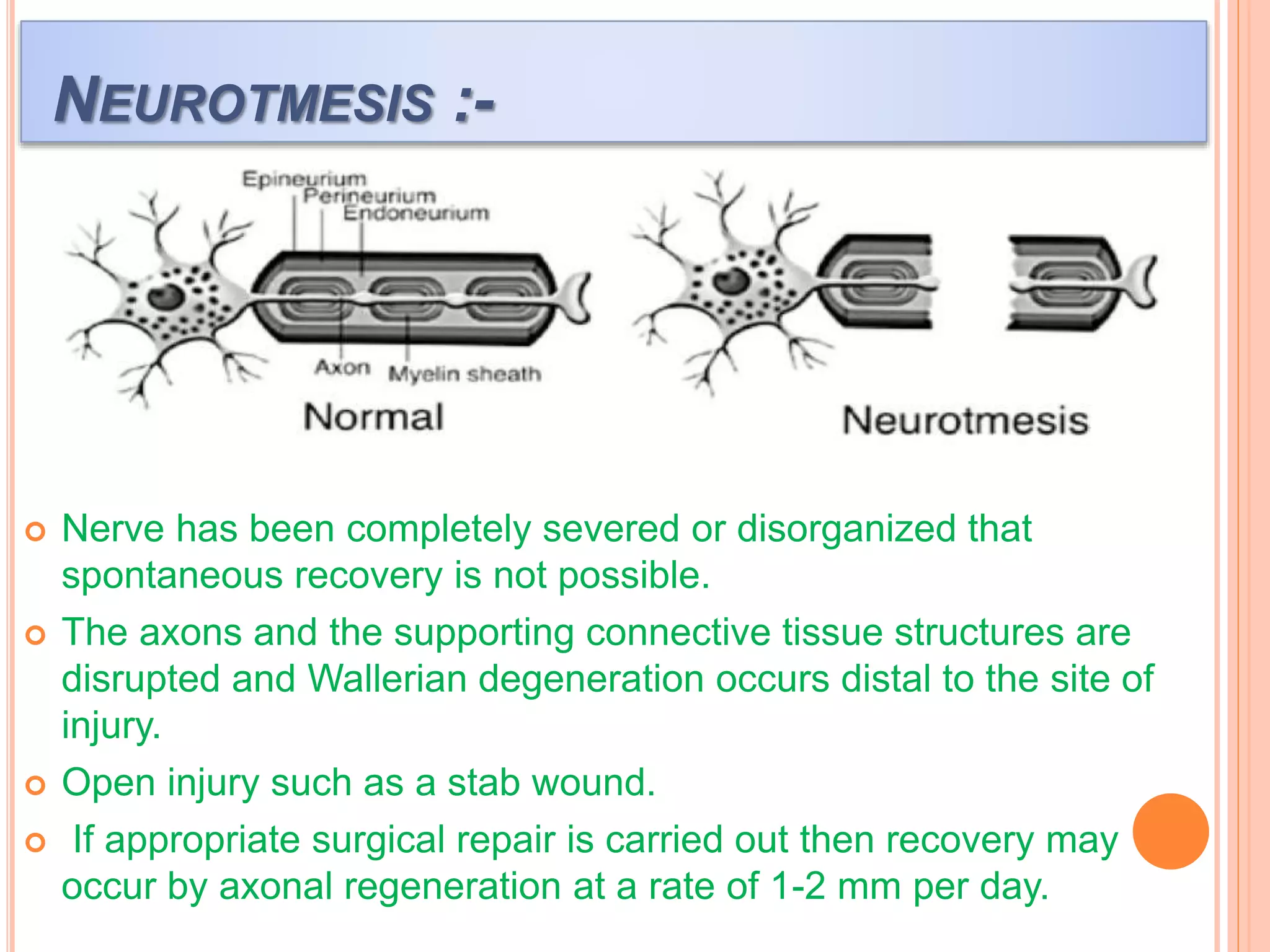 Peripheral nerve injury | PPTX