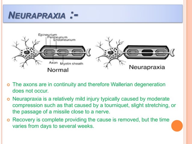Peripheral nerve injury | PPTX | First Aid | Injuries