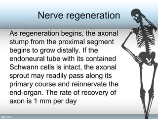 Peripheral nerve injury | PPT