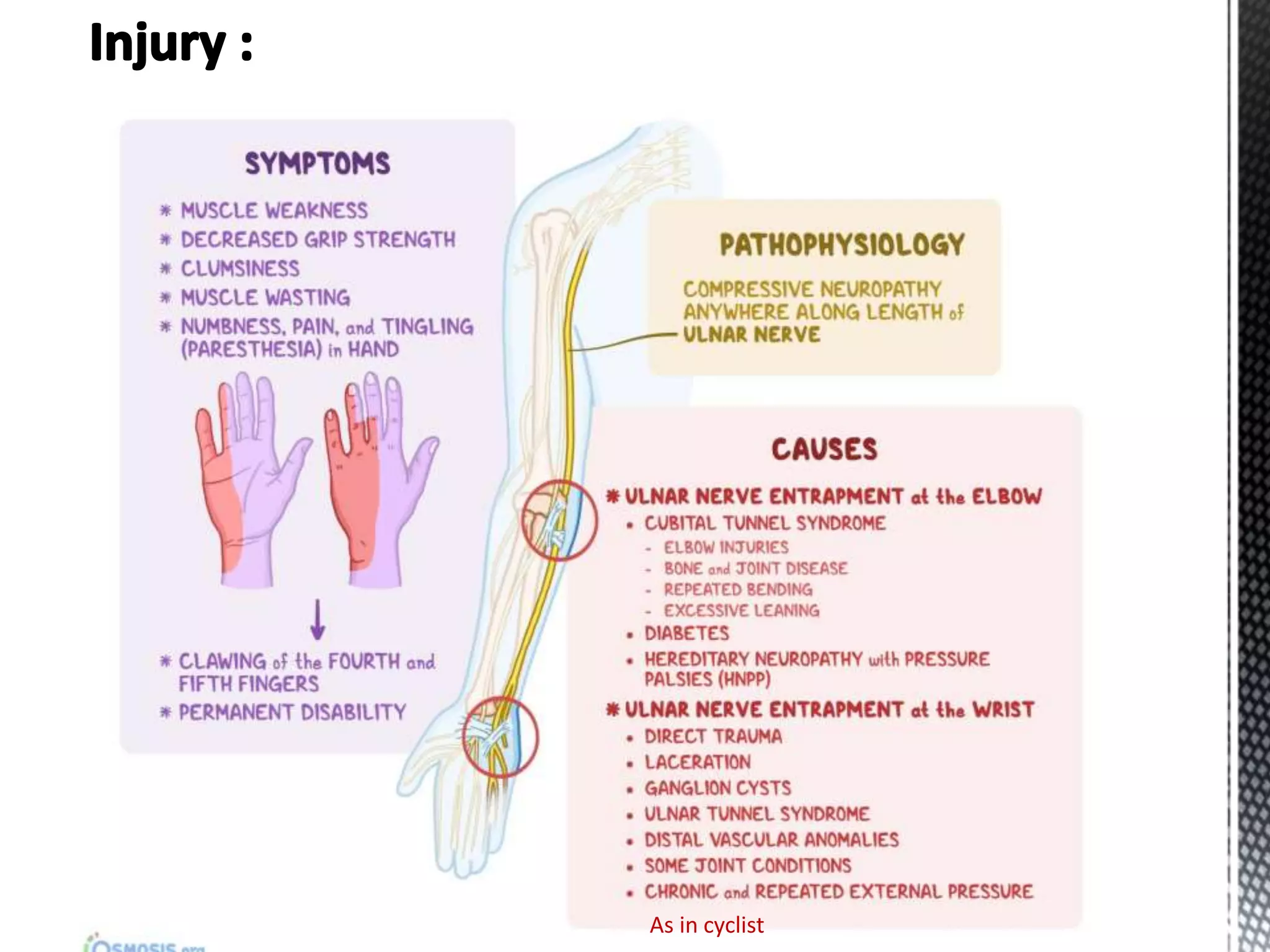Peripheral Nerve Injury | PPTX