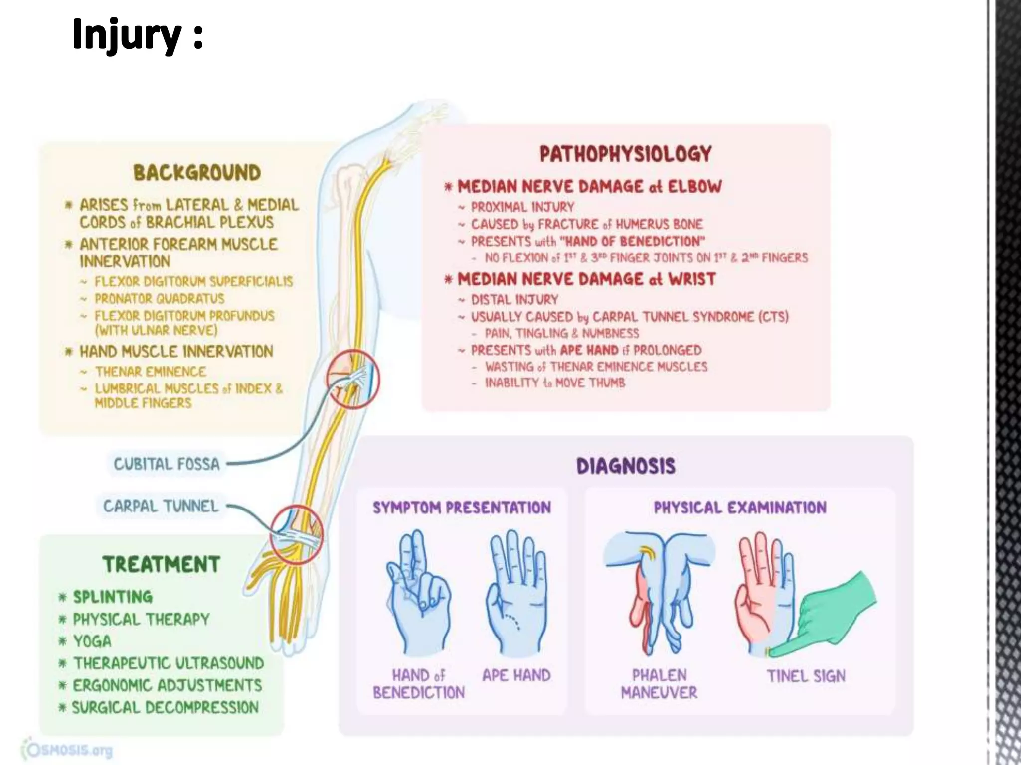 Peripheral Nerve Injury | PPTX