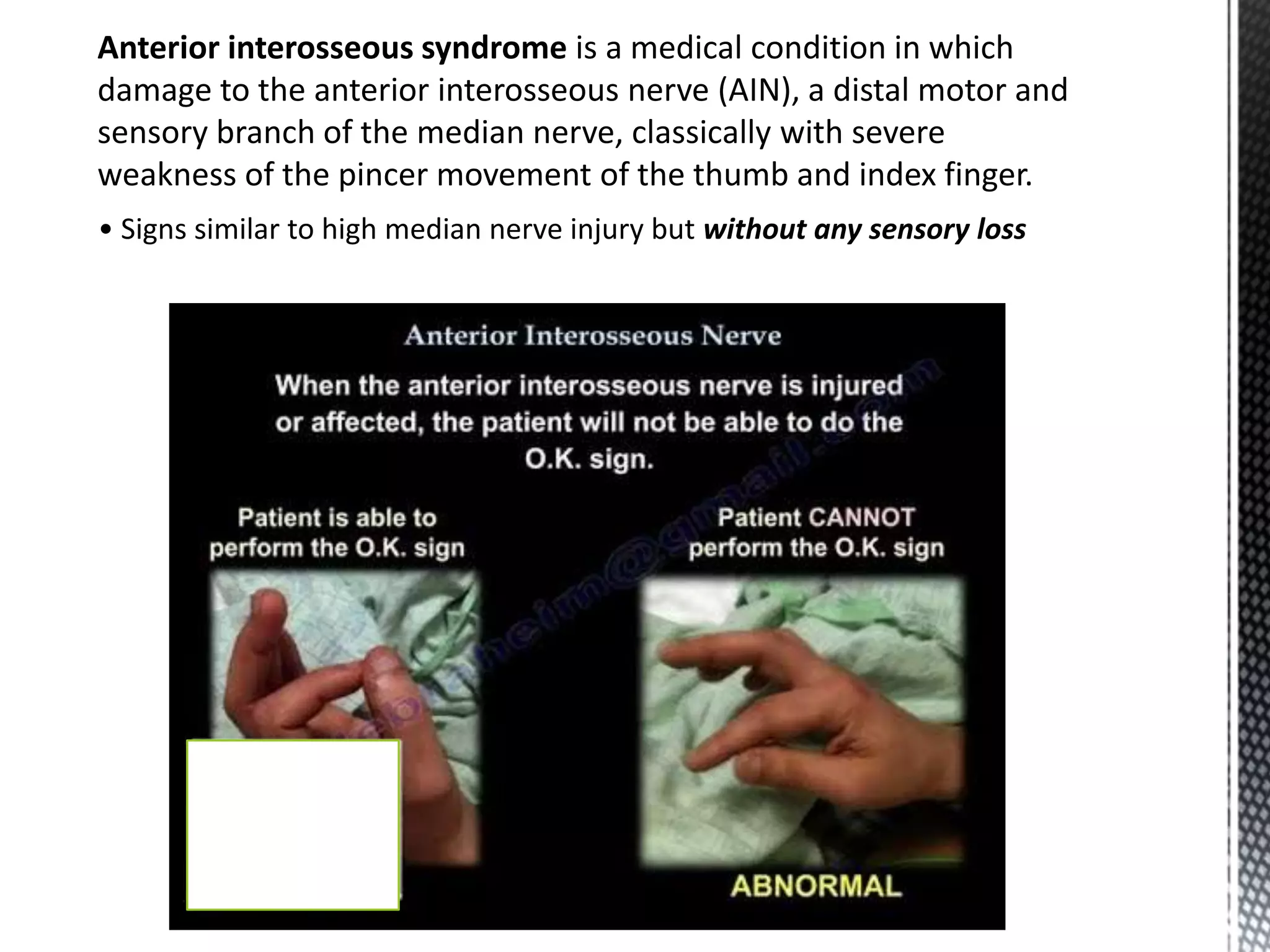 Peripheral Nerve Injury | PPTX