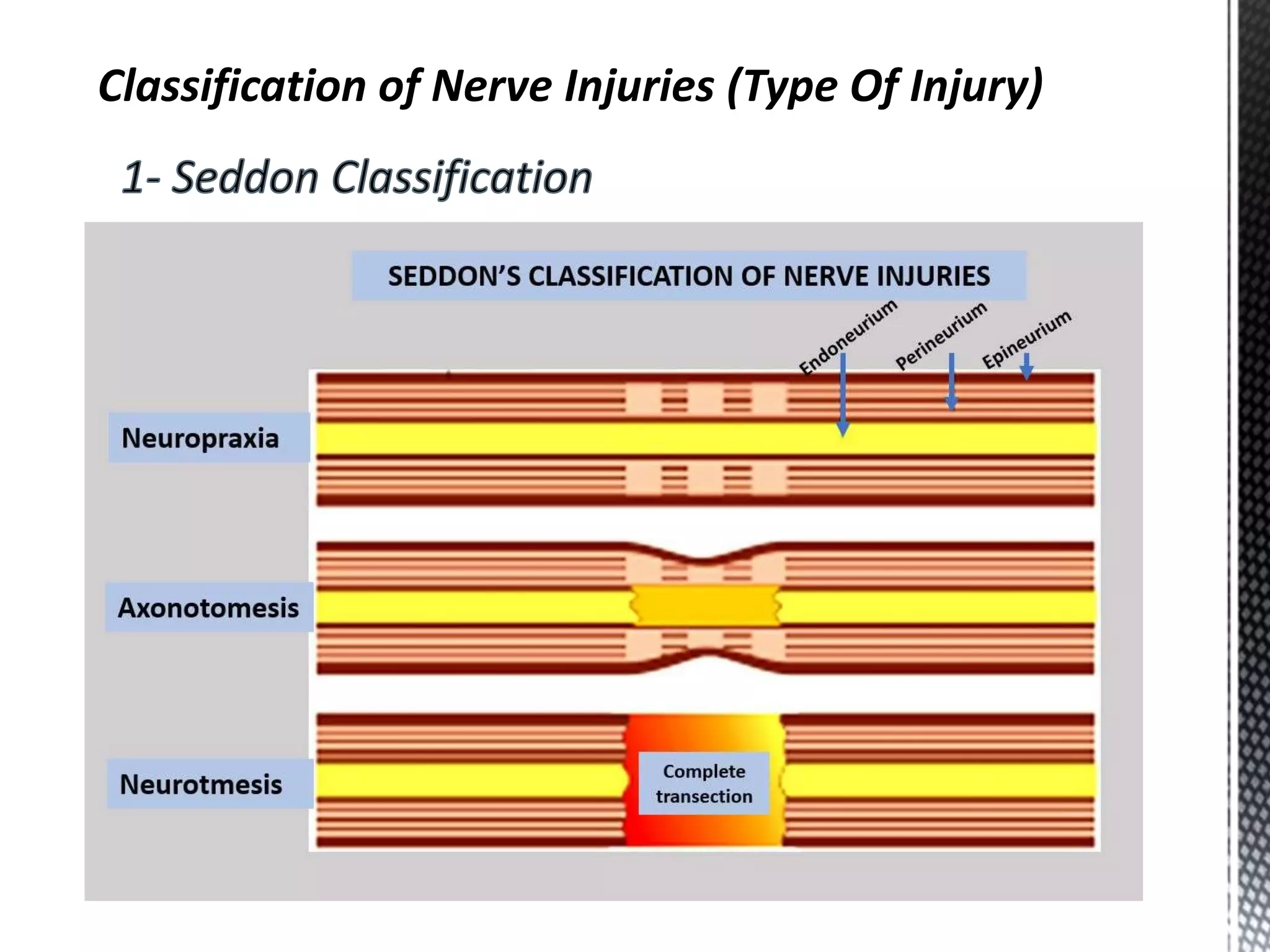 Peripheral Nerve Injury | PPTX