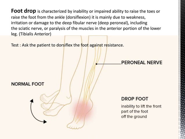 Peripheral Nerve Injury | PPTX