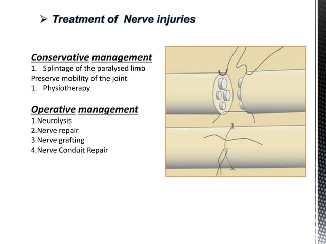 Peripheral Nerve Injury | PPTX