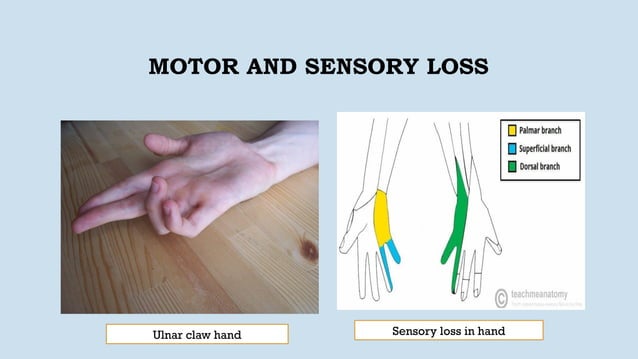 Peripheral nerve injury and entrapment neuropathy-1.pptx
