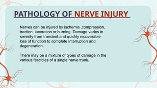 peripheral nerve injury by srija sen chowdhury .pptx