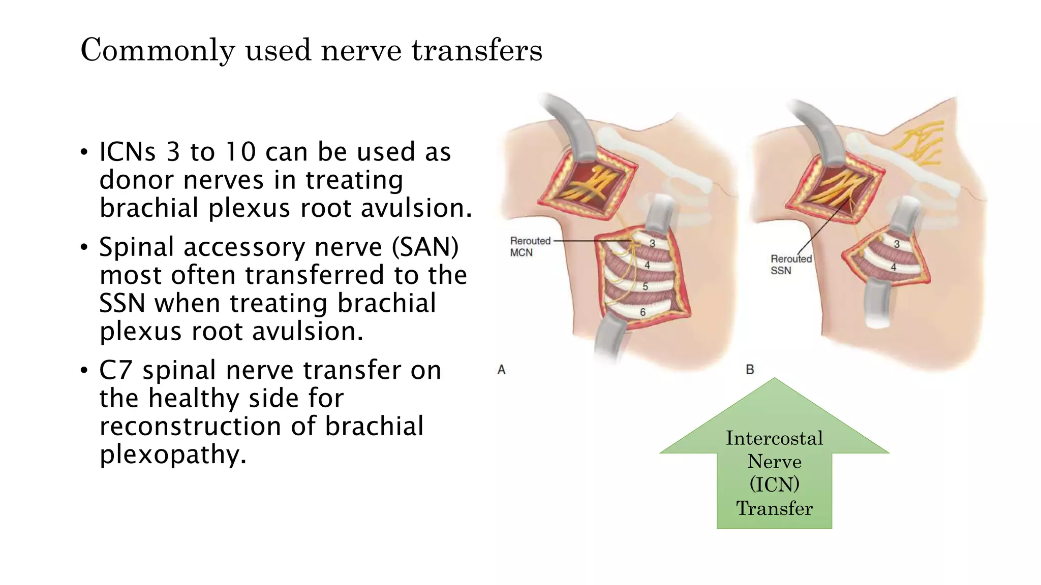 peripheral nerve injury new.pptx
