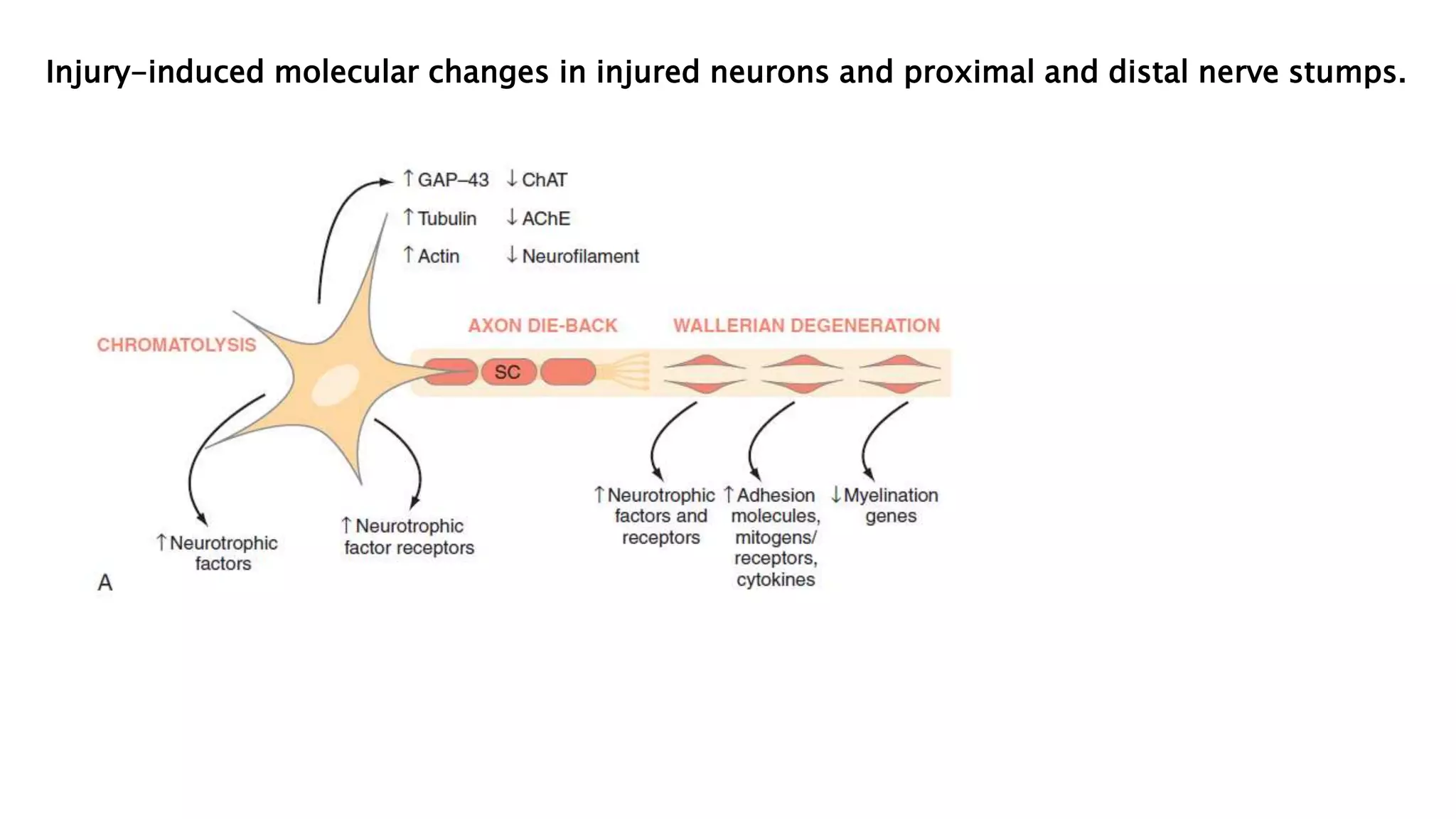 peripheral nerve injury new.pptx