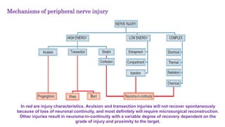 peripheral nerve injury new.pptx