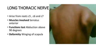 Peripheral nerve injuries of upper limb | PPTX