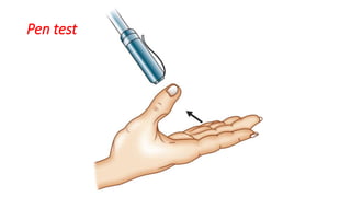Peripheral nerve injuries of upper limb | PPTX